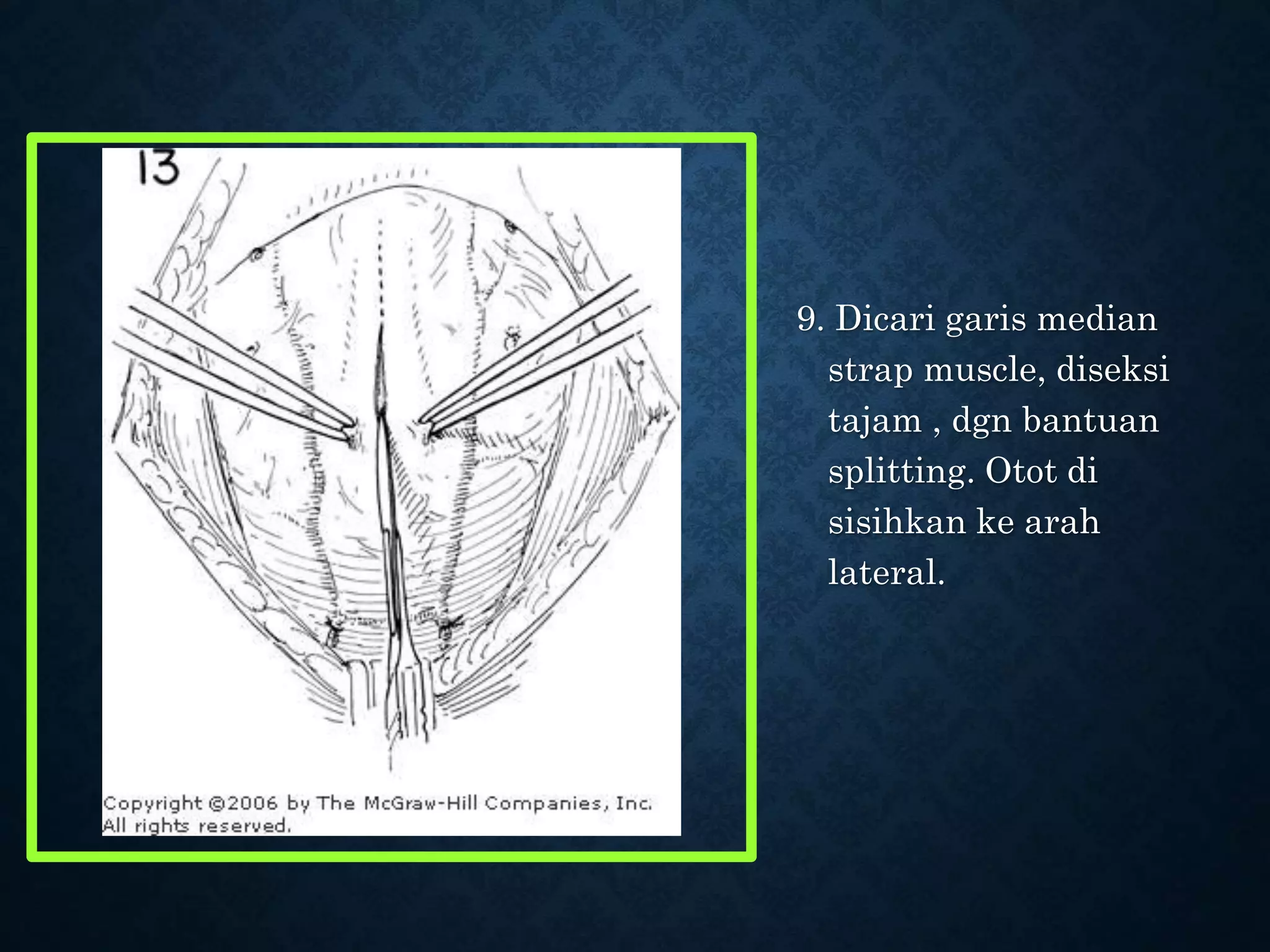 total tiroidektomi | PPTX
