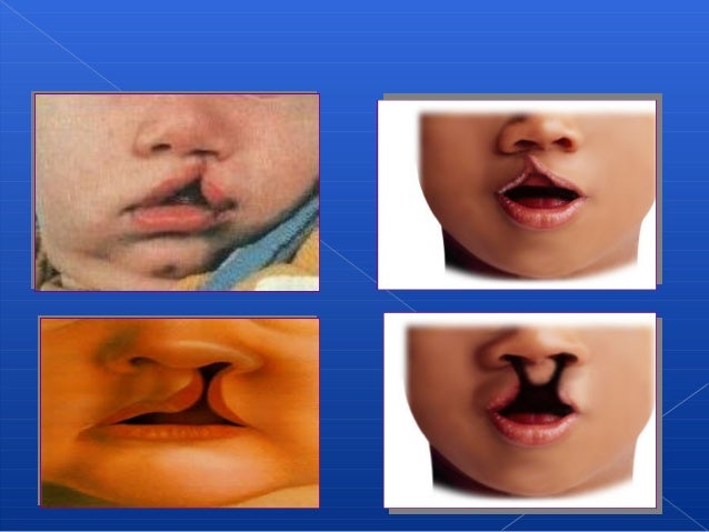 Modu[o 3 seminario de disglosias