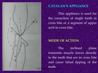 Modus operandi | PPT
