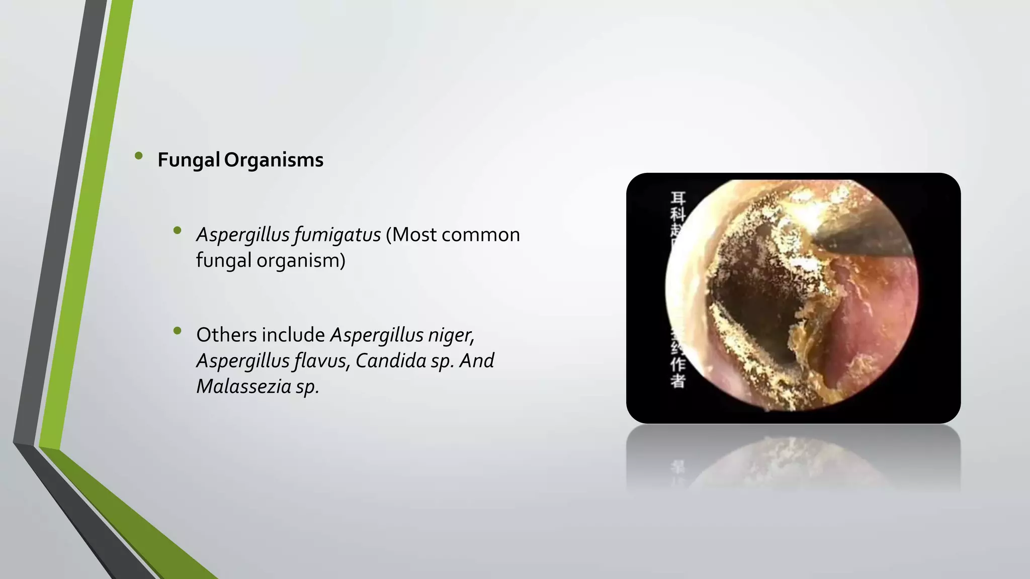 Malignant Otitis Externa/ Skull Base osteomyelitis | PPTX