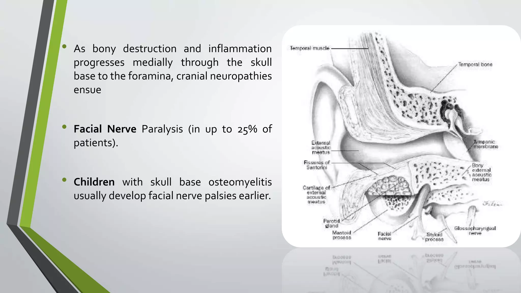 Malignant Otitis Externa/ Skull Base osteomyelitis | PPTX
