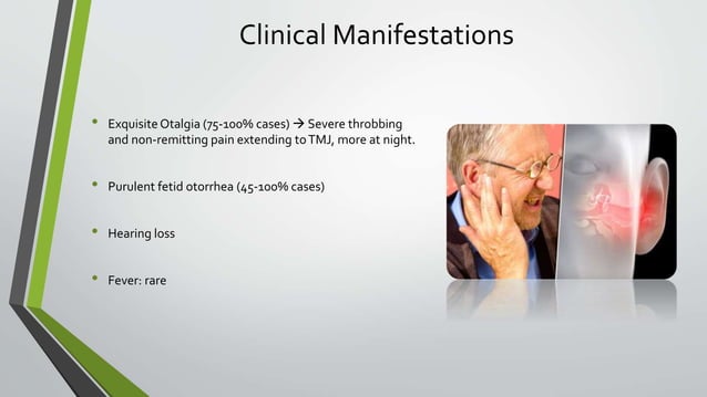 Malignant Otitis Externa/ Skull Base osteomyelitis | PPTX