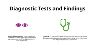 Medical genetics about Moebius Syndrome.pptx