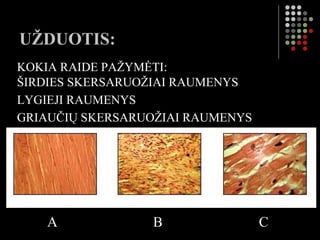 žMogaus raumenys | PPT