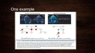 MOGES classification of cardiomyopathy 2013 | PPTX