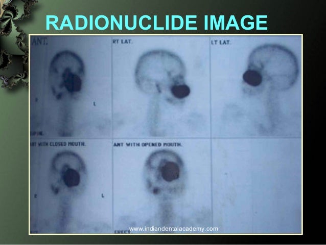 Radionuclide Imaging Dental Courses