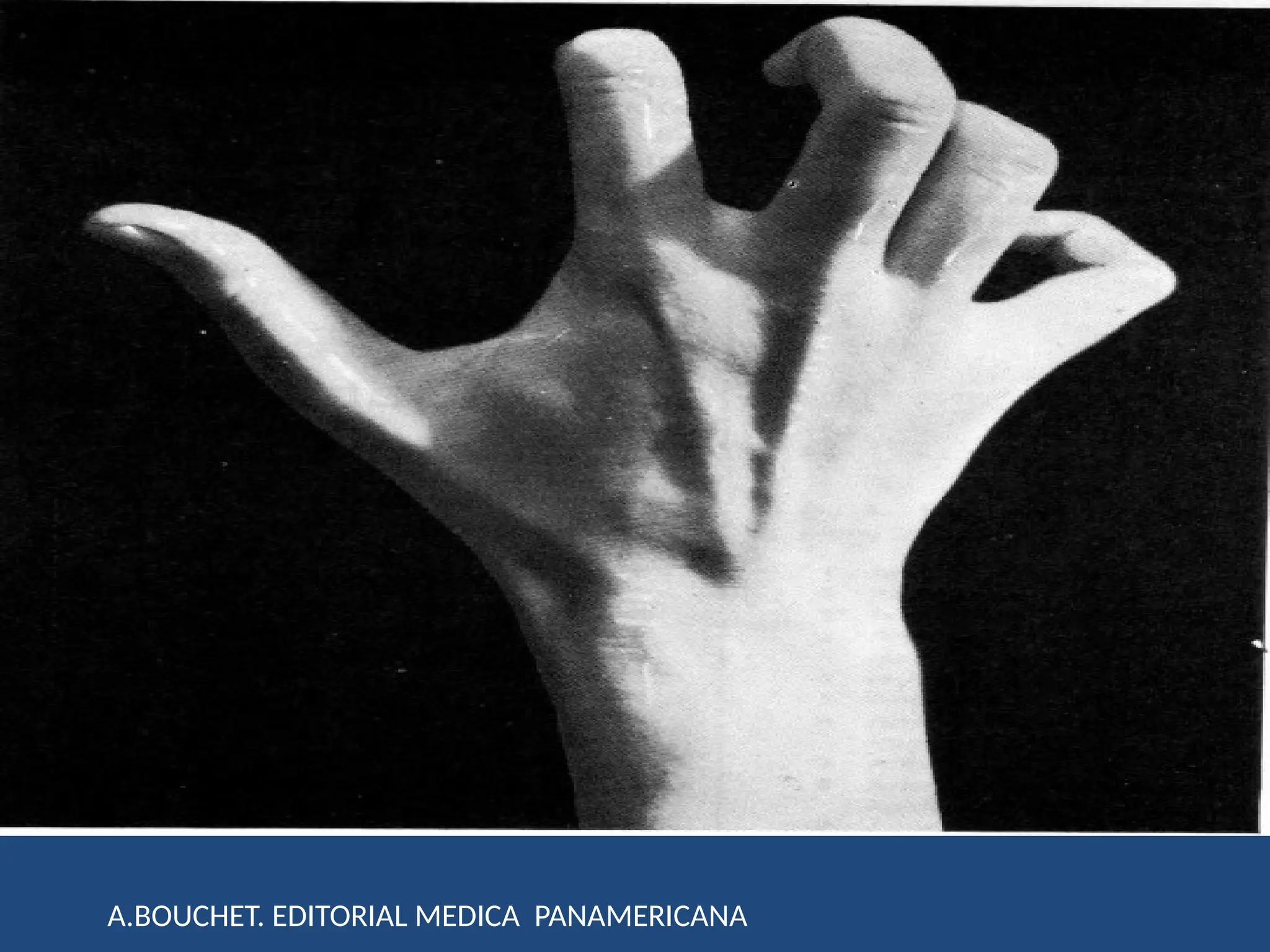Mohamed Seminario de ANATOMIA DE LA REGIÓN DORSAL DE MANO Y DEDOS ...
