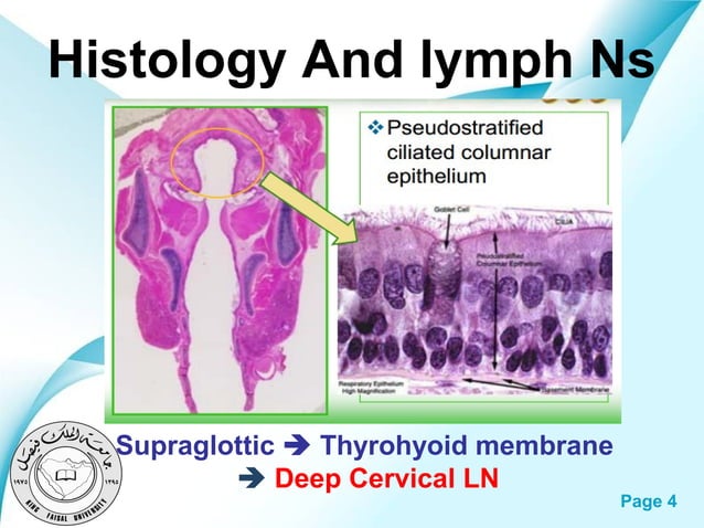 Supraglottic Cancer | PPT