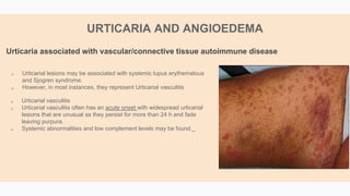 Urticaria | PPTX