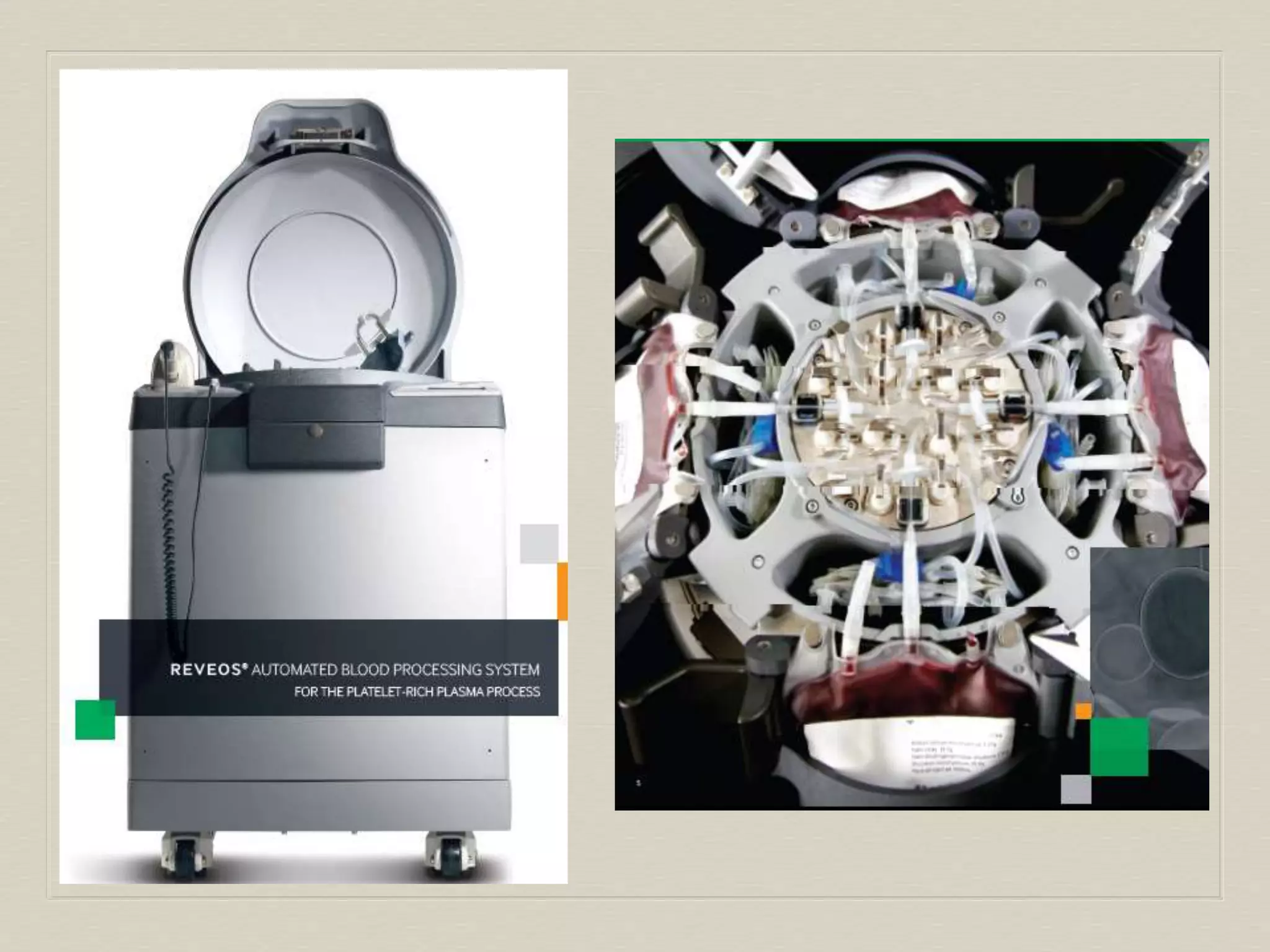 Buffy Coat Method of Component Preparation | PPTX