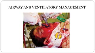 AIRWAY AND VENTILATORY MANAGEMENT OF TRAUMA PATIENTS 1 -.pptx