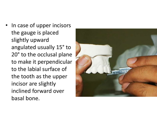 bracket gauges and placement | PPTX | Dental Health | Diseases and ...