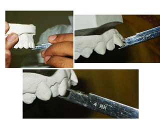 bracket gauges and placement | PPTX