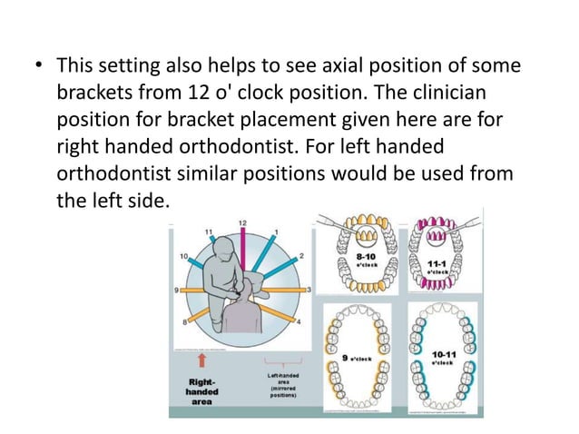 bracket gauges and placement | PPTX | Dental Health | Diseases and ...
