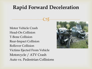Mechanism of Injury | PPTX