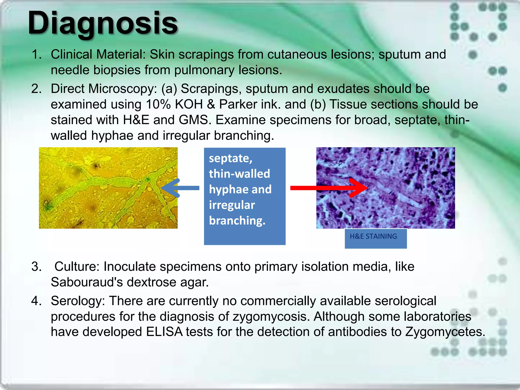 Pathogenesis,pathology and diagnosis of Cryptococcosis,Histoplasmosis ...