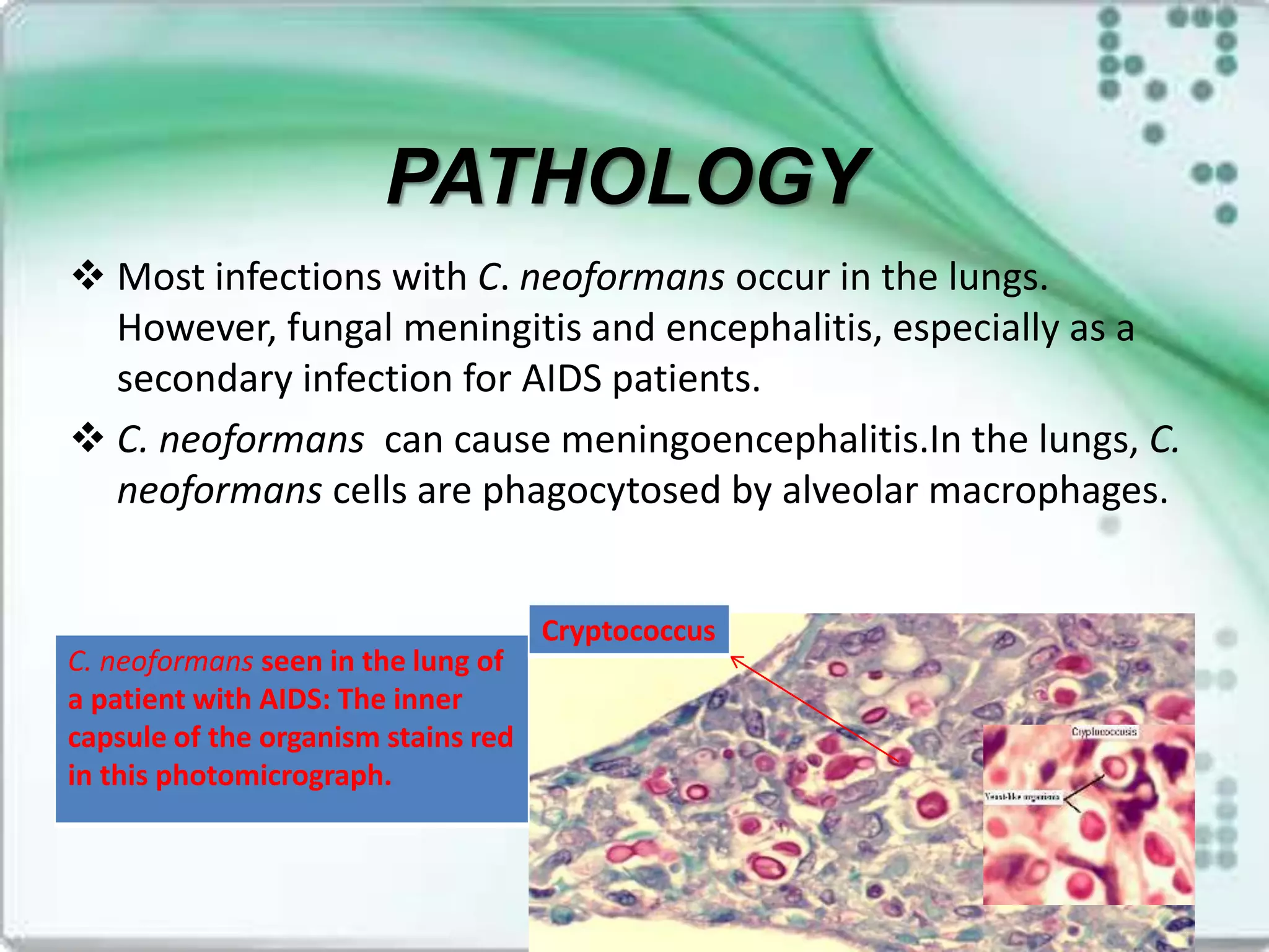 Pathogenesis,pathology and diagnosis of Cryptococcosis,Histoplasmosis ...