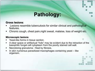 Pathogenesis,pathology and diagnosis of Cryptococcosis,Histoplasmosis ...