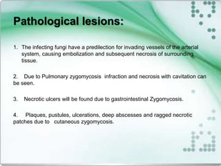 Pathogenesis,pathology and diagnosis of Cryptococcosis,Histoplasmosis ...