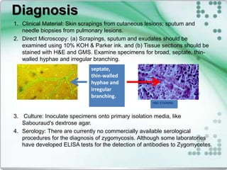 Pathogenesis,pathology and diagnosis of Cryptococcosis,Histoplasmosis ...