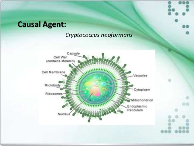 Pathogenesis,pathology and diagnosis of Cryptococcosis,Histoplasmosis…