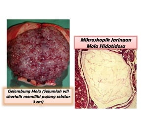 Mola.molamolamolamolamolamolamolamolamolamolamolamola | PPTX