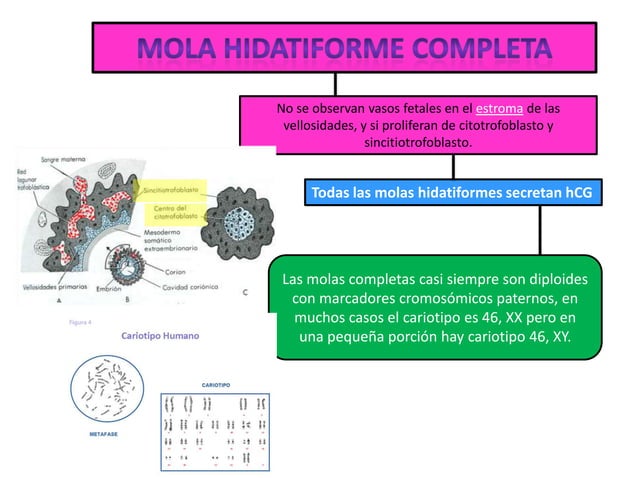 Mola hidatiforme, cuidados de enfermeria y DIAGNOSTICOS NANDA | PPTX