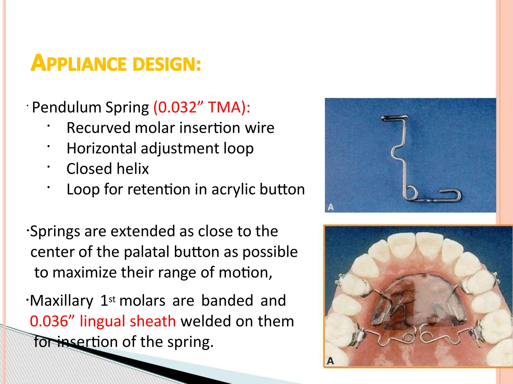 molar-distalization in orthodontics-seminar.pptx | Dental Health ...