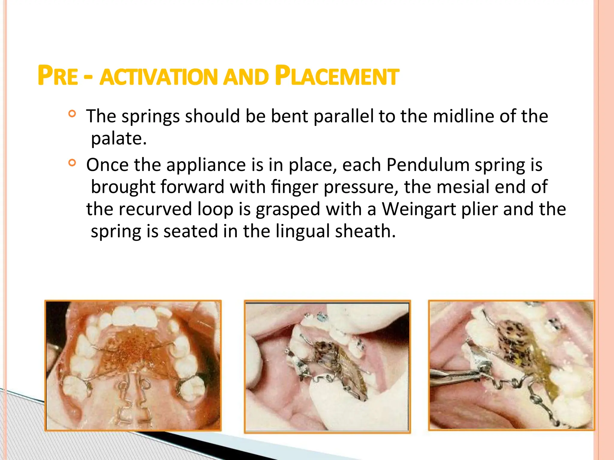 molar-distalization in orthodontics-seminar.pptx | Dental Health ...