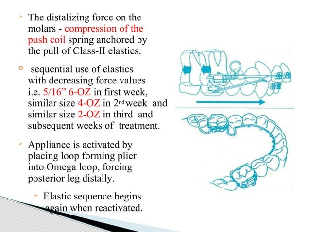 molar-distalization in orthodontics-seminar.pptx | Dental Health ...
