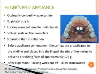 molar-distalization in orthodontics-seminar.pptx