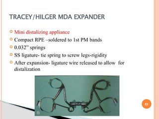 molar-distalization in orthodontics-seminar.pptx | Dental Health ...