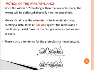 molar-distalization in orthodontics-seminar.pptx