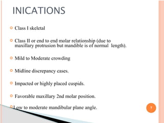 molar-distalization in orthodontics-seminar.pptx