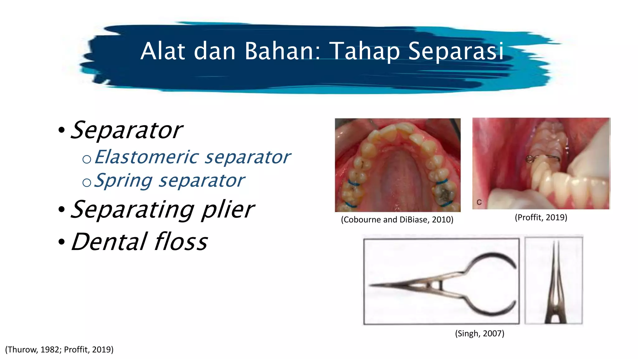 Molar band.pptx