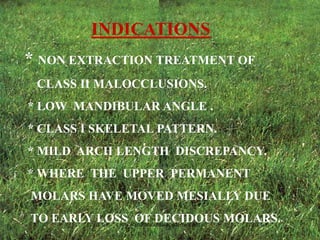Molar distalisation/fixed orthodontic courses by indian dental academy ...