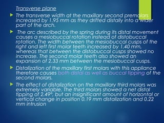 Molar distalisation | PPT