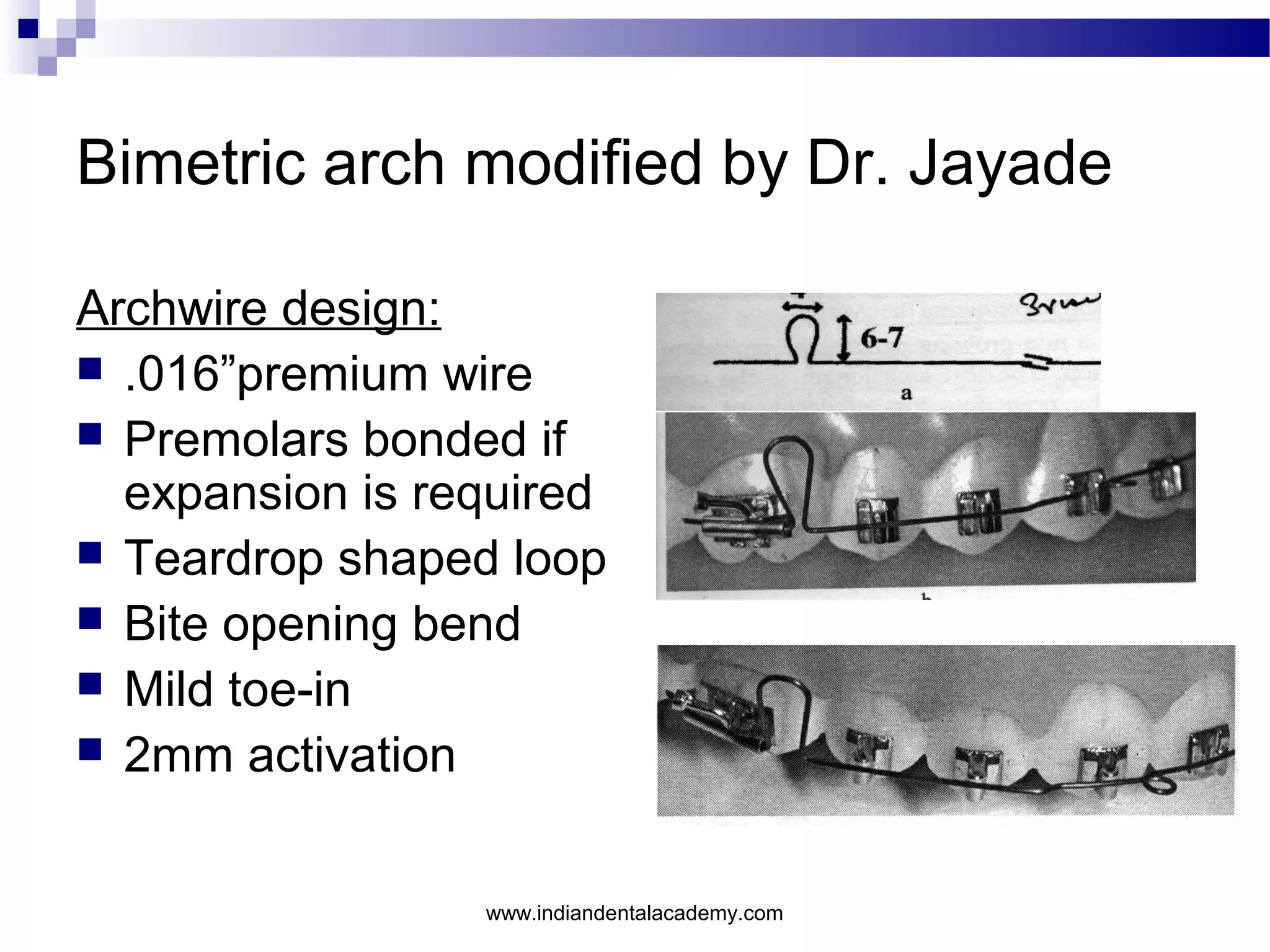 Molar distalization | PPT