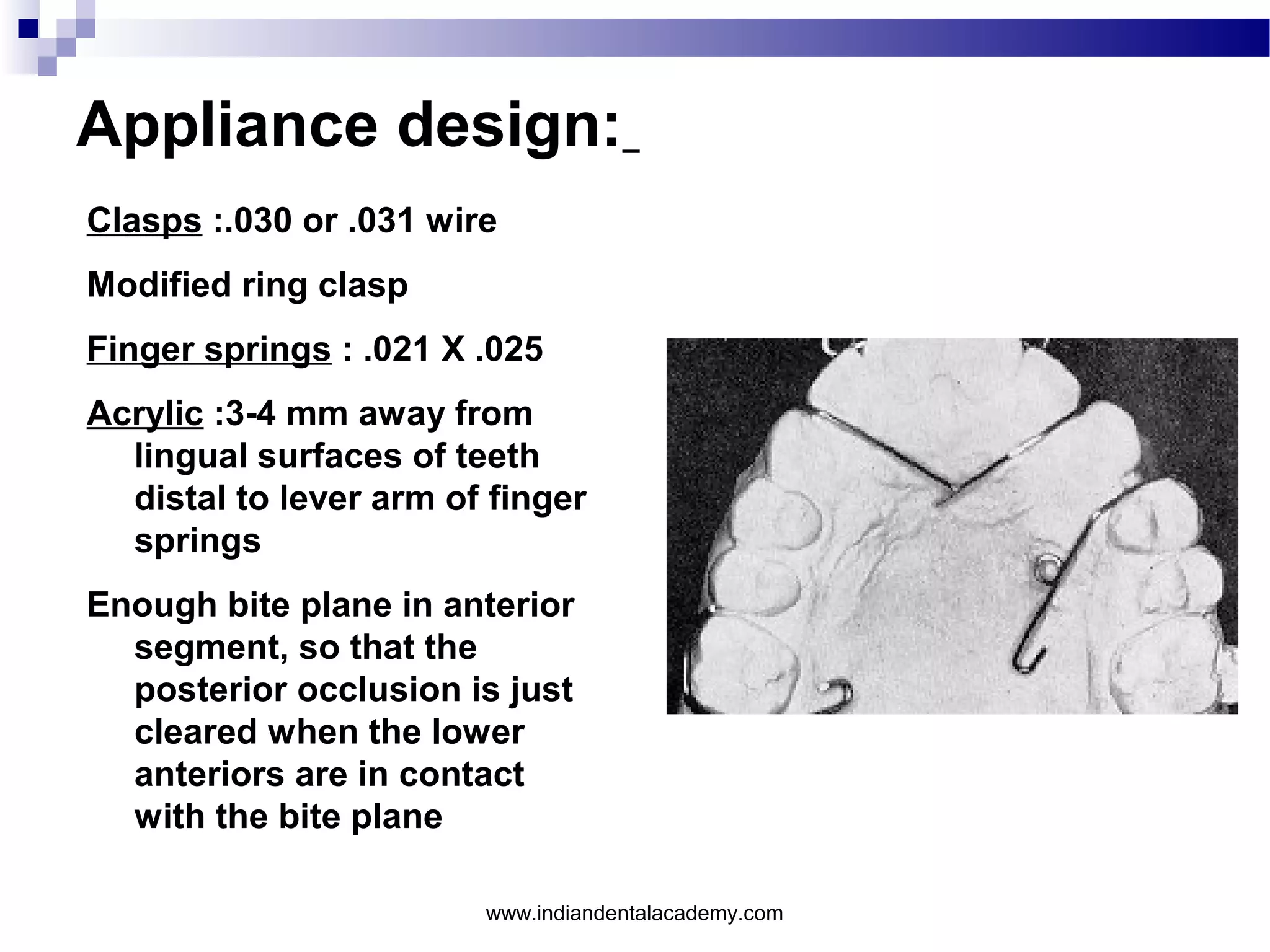 Molar distalization | PPT