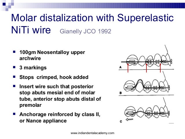Molar distalization