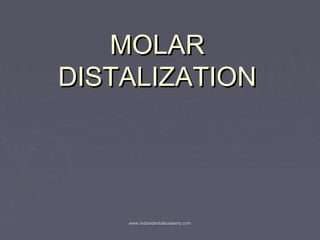 Molar distalization | PPT
