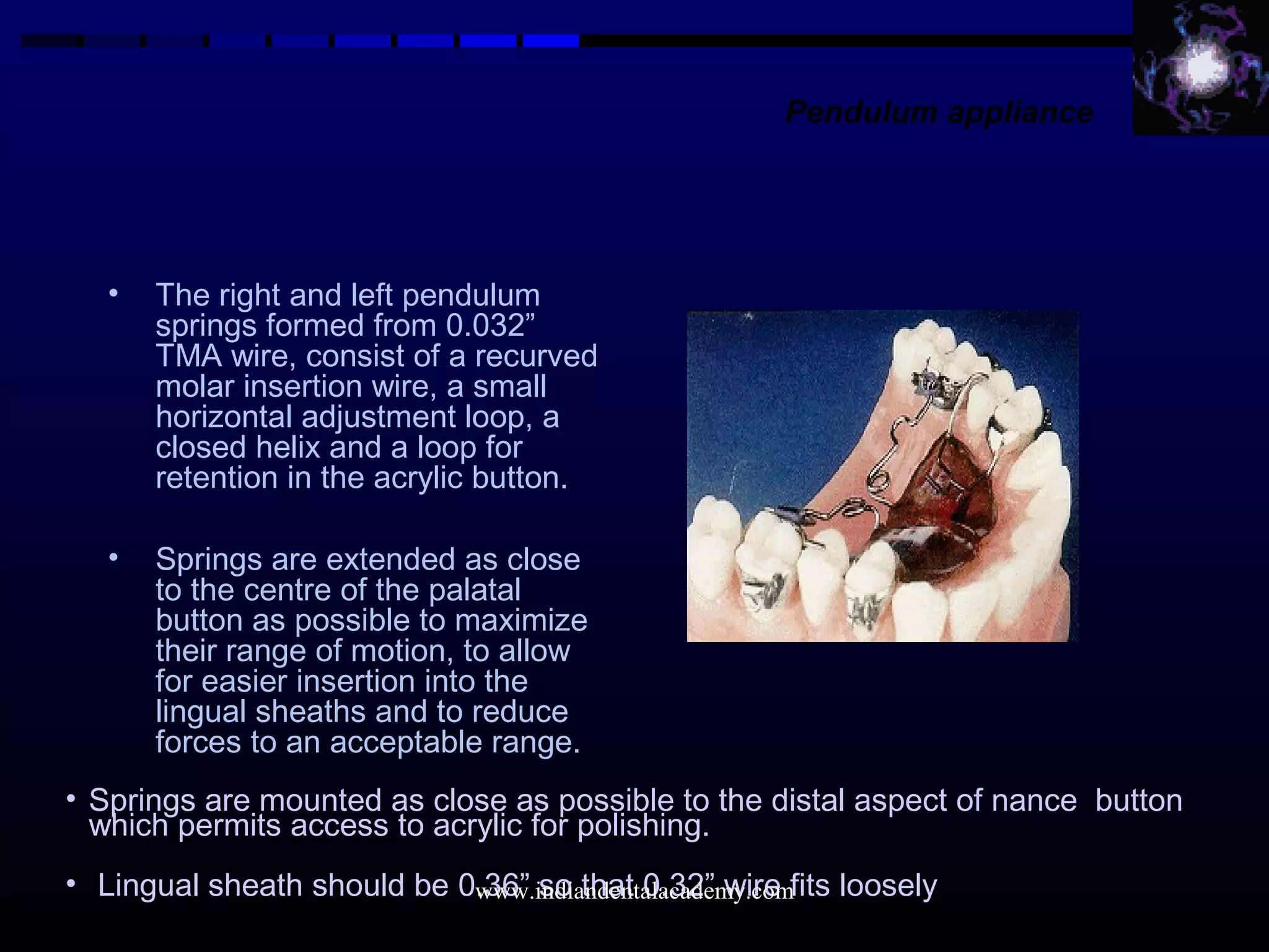 Molar distalization (2) | PPT