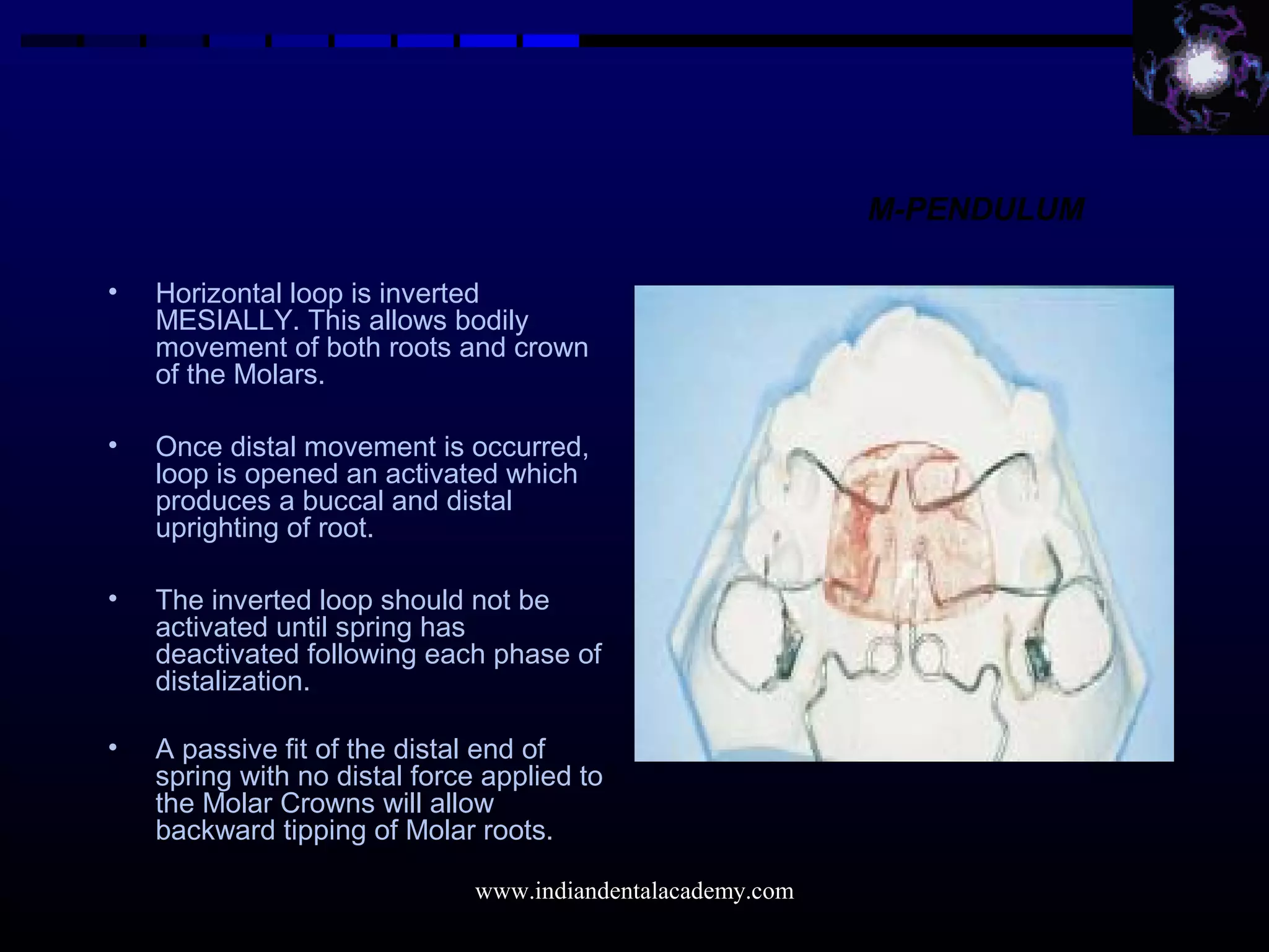 Molar distalization (2) | PPT