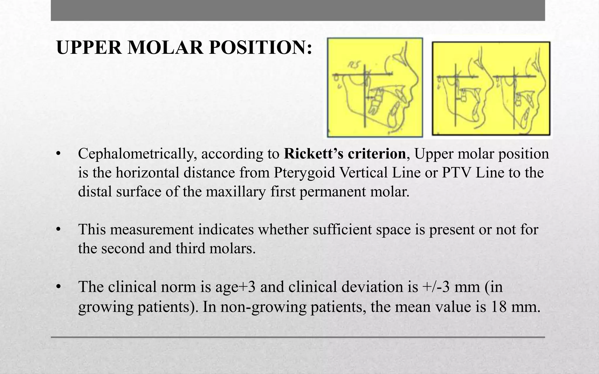 Molar distalisation in Orthodontics | PPTX