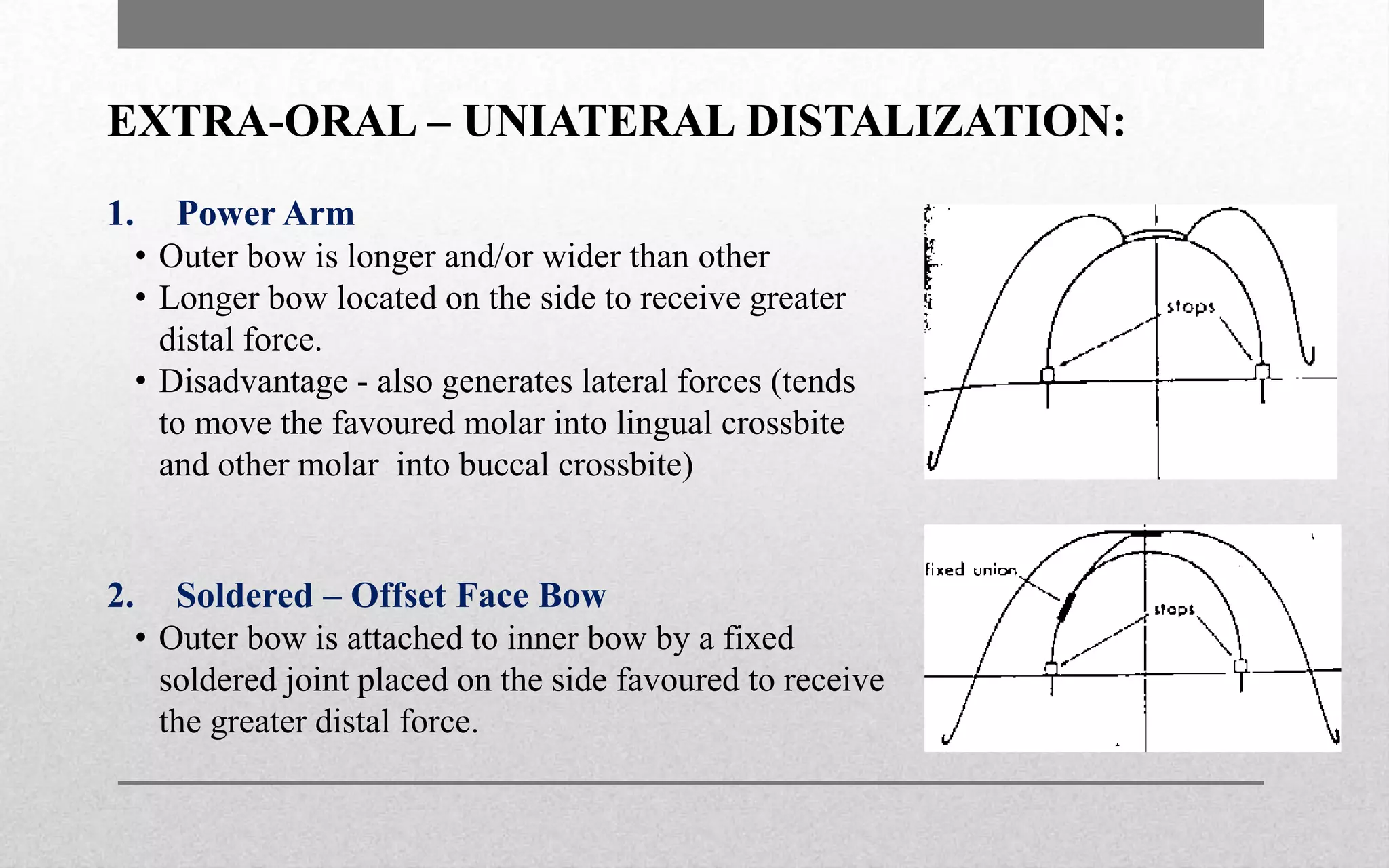 Molar distalisation in Orthodontics | PPTX