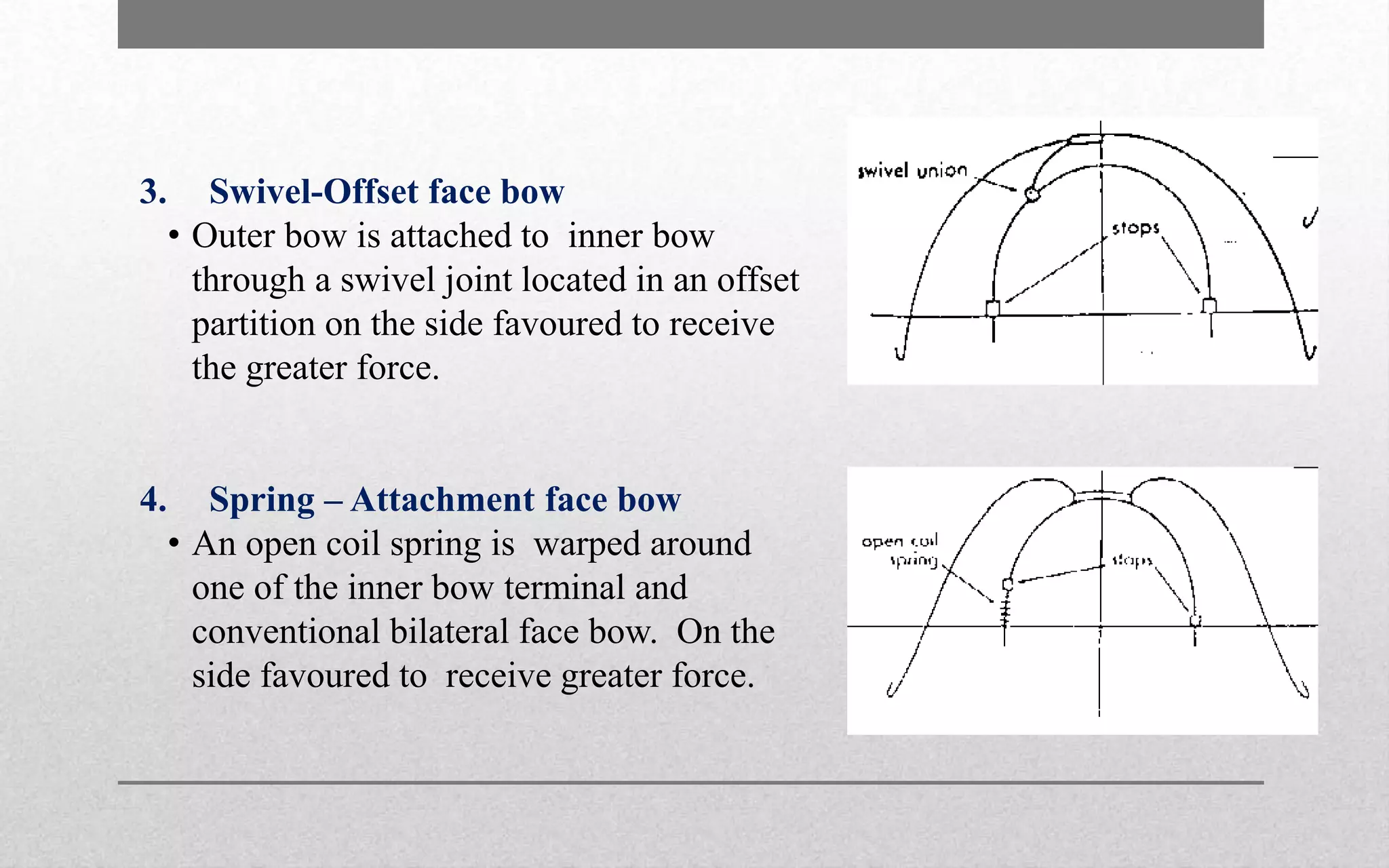 Molar distalisation in Orthodontics | PPTX
