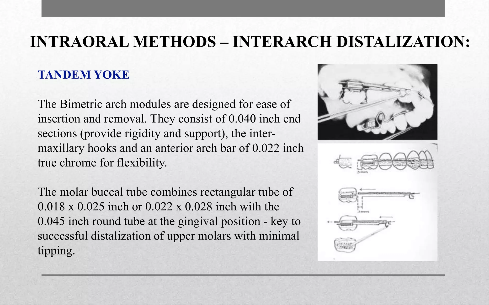 Molar distalisation in Orthodontics | PPTX