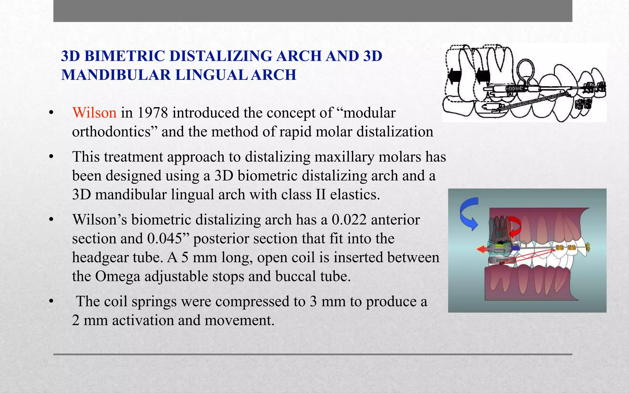Molar distalisation in Orthodontics | PPTX