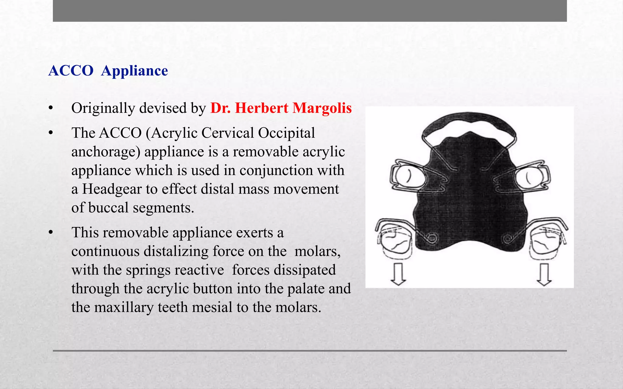 Molar distalisation in Orthodontics | PPTX
