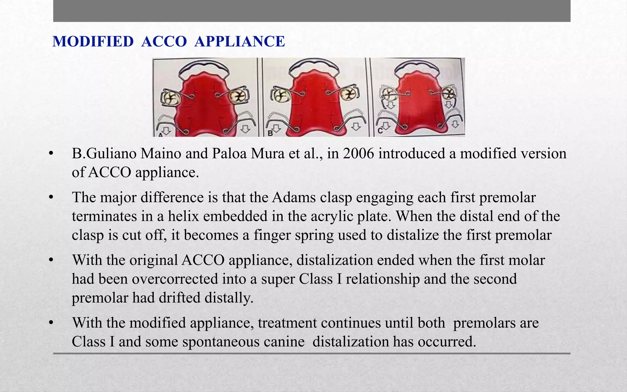 Molar distalisation in Orthodontics | PPTX